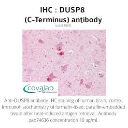 DUSP8 (C-Terminus) antibody