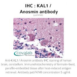 KAL1 / Anosmin antibody