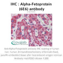Alpha-Fetoprotein (6E6) antibody