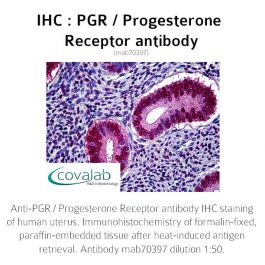 PGR / Progesterone Receptor antibody
