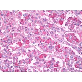 LHB / Luteinizing Hormone (LH01) antibody