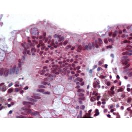 FOXC1 (aa250-300) antibody