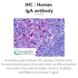 Human IgA antibody
