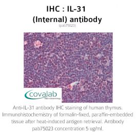 IL-31 (Internal) antibody