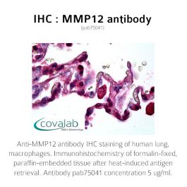 MMP12 antibody