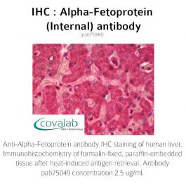 Alpha-Fetoprotein (Internal) antibody