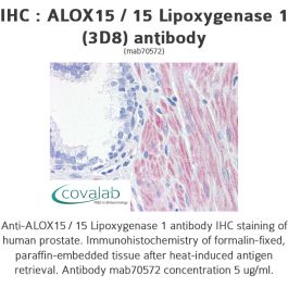 ALOX15 / 15 Lipoxygenase 1 (3D8) antibody