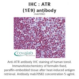 ATR (1E9) antibody