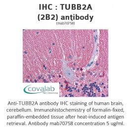 TUBB2A (2B2) antibody