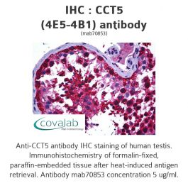 CCT5 (4E5-4B1) antibody