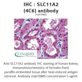 SLC11A2 (4C6) antibody