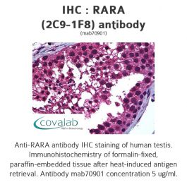 RARA (2C9-1F8) antibody