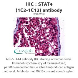 STAT4 (1C2-1C12) antibody
