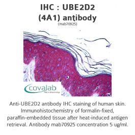 UBE2D2 (4A1) antibody