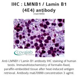 LMNB1 / Lamin B1 (4E4) antibody