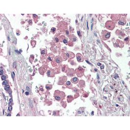 CD14 (61D3) antibody