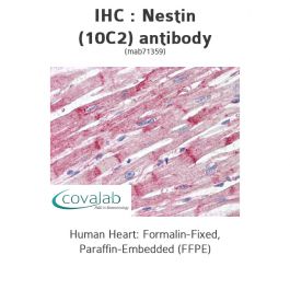 Nestin (10C2) antibody