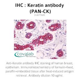 Keratin antibody (PAN-CK)