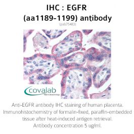 EGFR (aa1189-1199) antibody