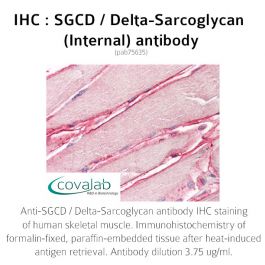 SGCD / Delta-Sarcoglycan (Internal) antibody