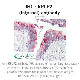RPLP2 (Internal) antibody