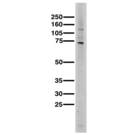 Cavβ2 Ca+2 Channel (S8b-1) antibody