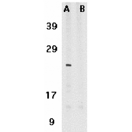 PYCARD antibody