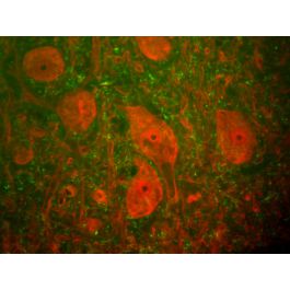 Neurofilament heavy chain (NF-H) antibody