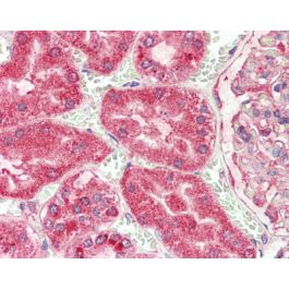 Angiogenin / ANG (Internal) antibody