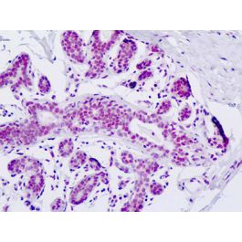 ZMYND8 / RACK7 (aa581-630) antibody