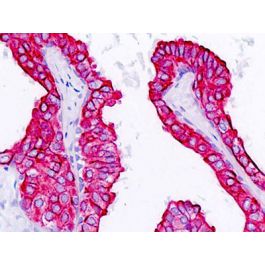 KRT18 / CK18 / Cytokeratin 18 (C-Terminus) antibody
