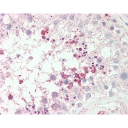 Acrosin (aa 387-416) antibody