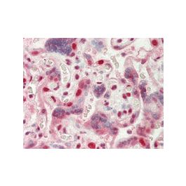 GTF2I antibody (3E2)