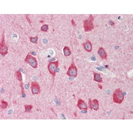 MAP1LC3B (aa109-138) antibody