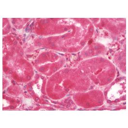 MAP1LC3A (N-Terminus) antibody