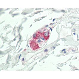 CYR61 (aa47-332) antibody