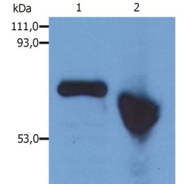 alpha-Fetoprotein antibody (AFP-01)